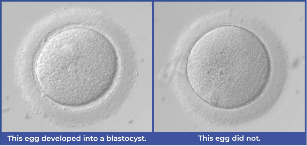How does your egg contribute to healthy embryo development? - Future ...