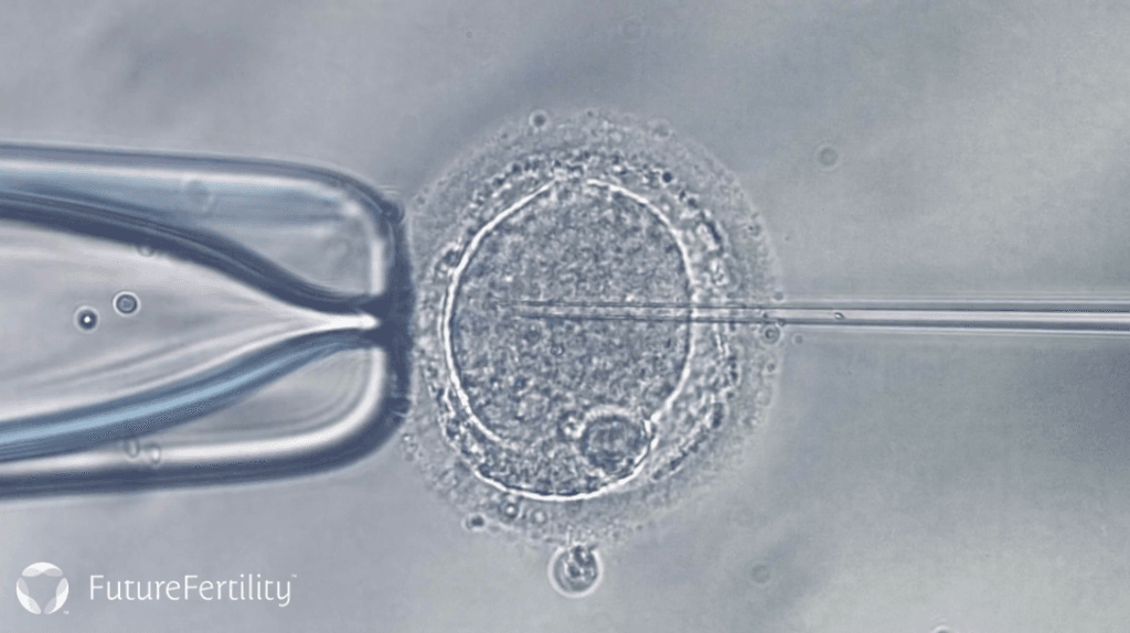 ABCs of Fertility - Future Fertility