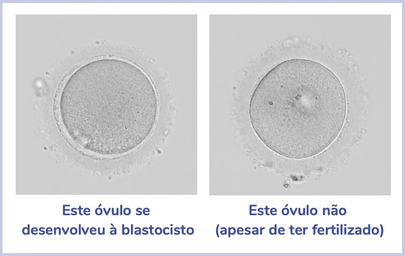 Como seu óvulo contribui para o desenvolvimento saudável do embrião ...