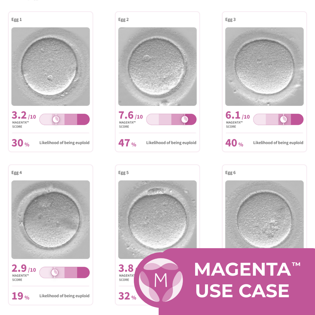 USE CASE: Using MAGENTA™ to Improve Blastocyst Rates When Oocyte ...